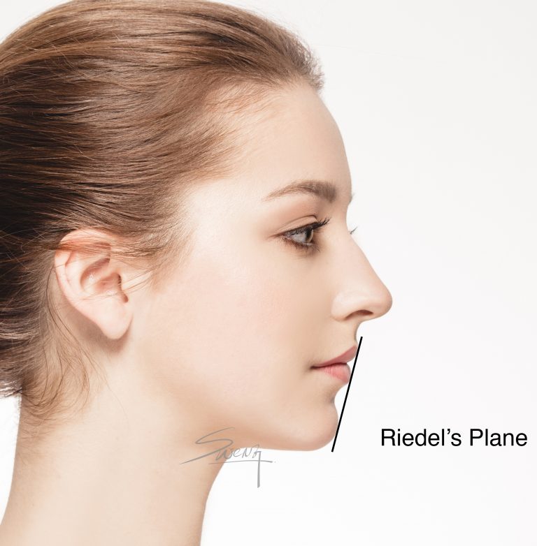 AESTHETIC PROPORTIONS OF THE CHIN